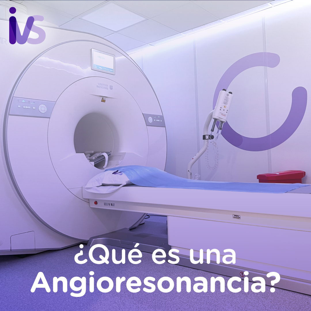 ¿Qué es una angioresonancia? – Imágenes de Vida Y Salud