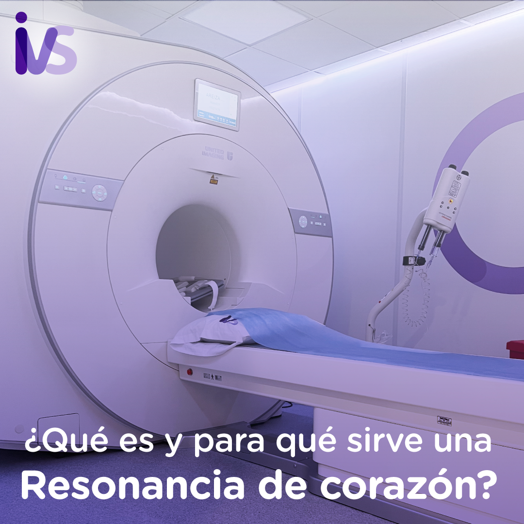 ¿Qué es y para qué sirve una resonancia de corazón? – Imágenes de Vida ...