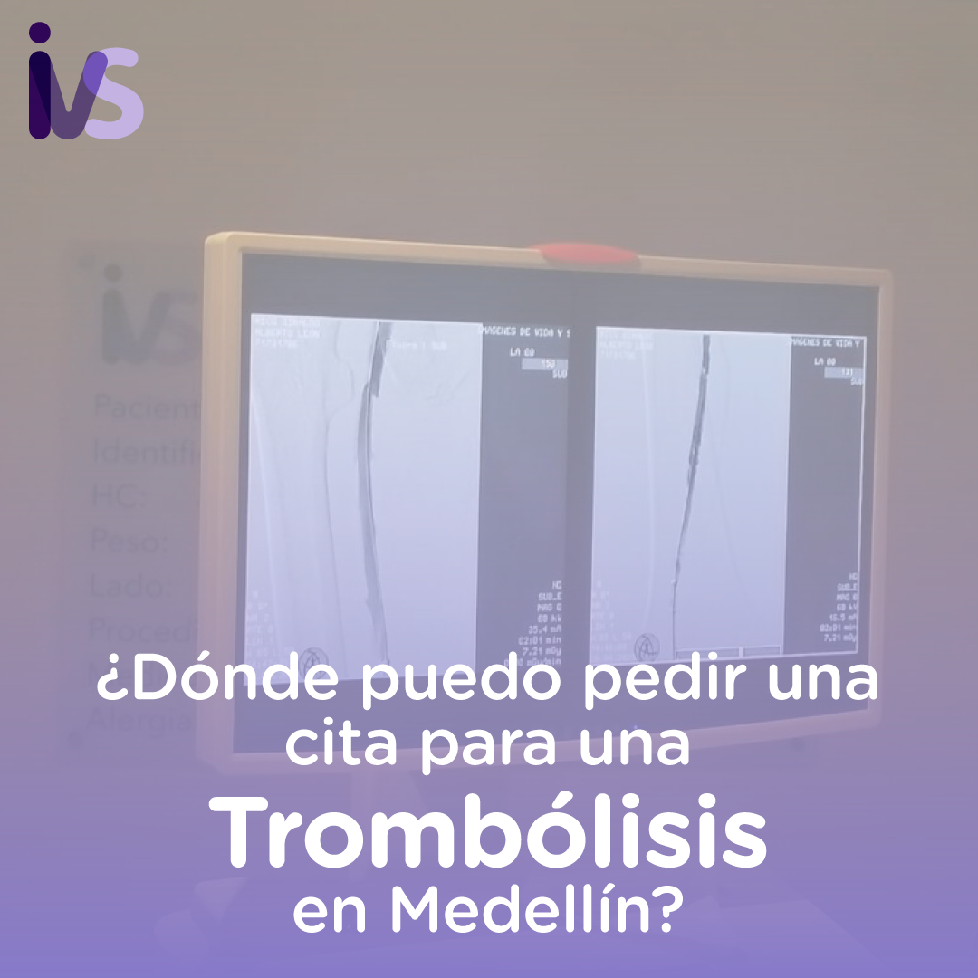 ¿Qué es y dónde puedo pedir una cita para trombólisis en Medellín ...